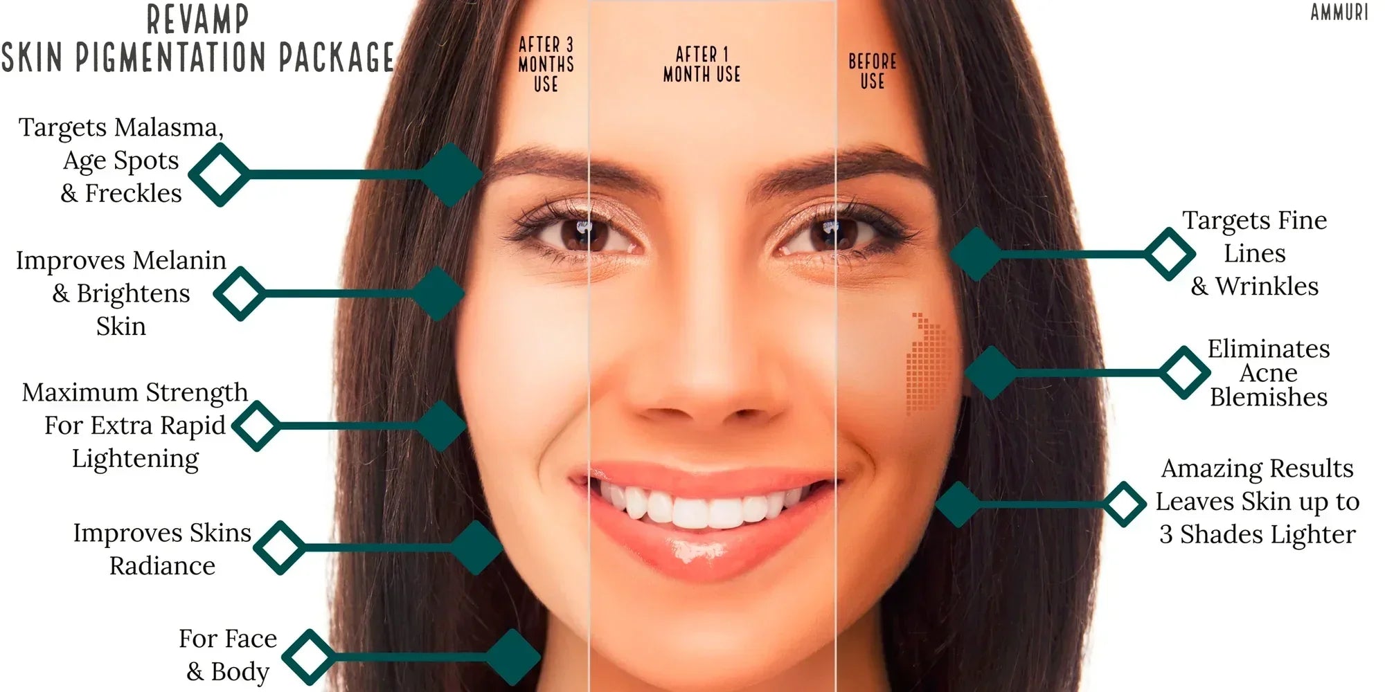 REVAMP Skin Pigmentation Package – Ammuri Beauty